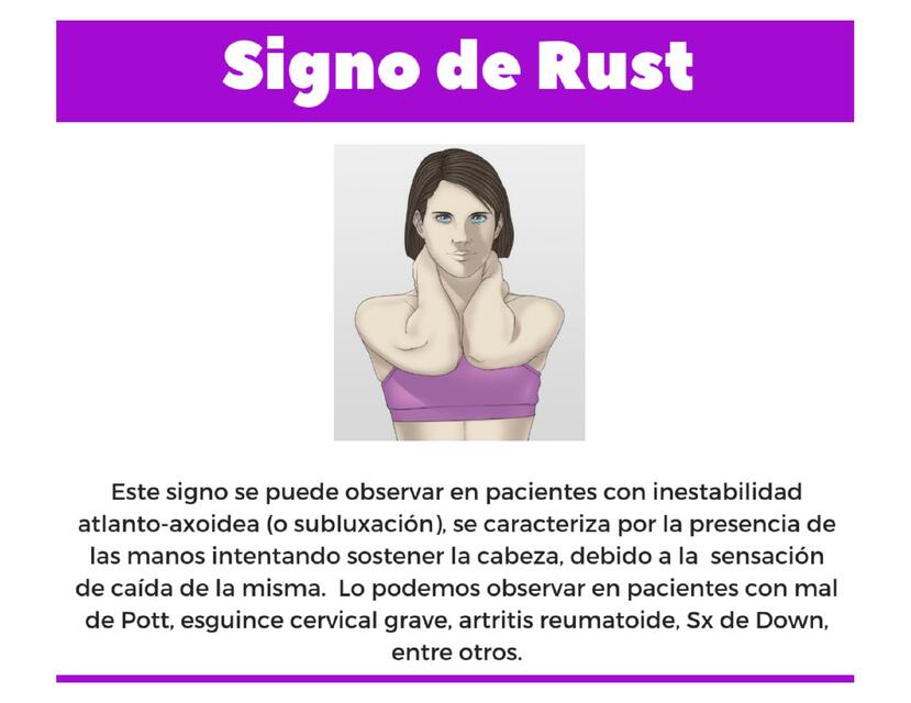 Signo de RUST
