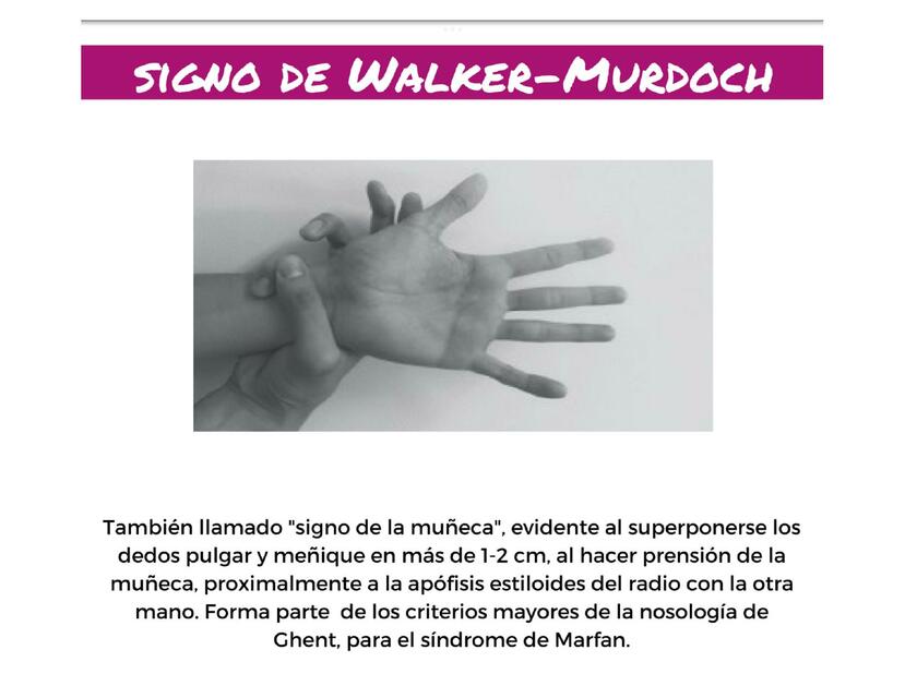 Signo de Walker Murdoch | uDocz