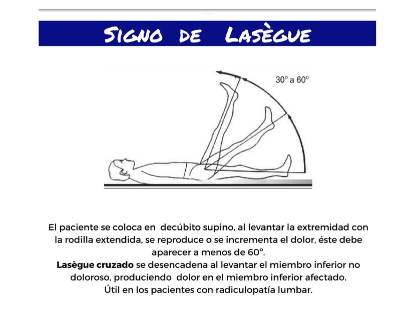 Signo de Laségue | uDocz