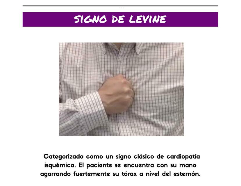 Signo de Levine | uDocz