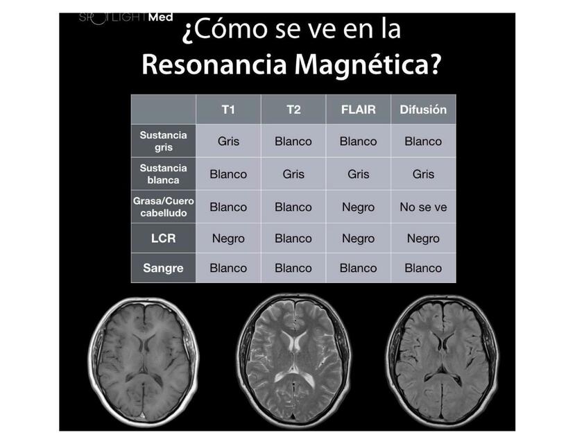 Visualización de Resonancia Magnética | uDocz