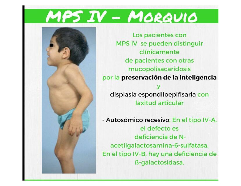 MPS IV MORQUIO | uDocz