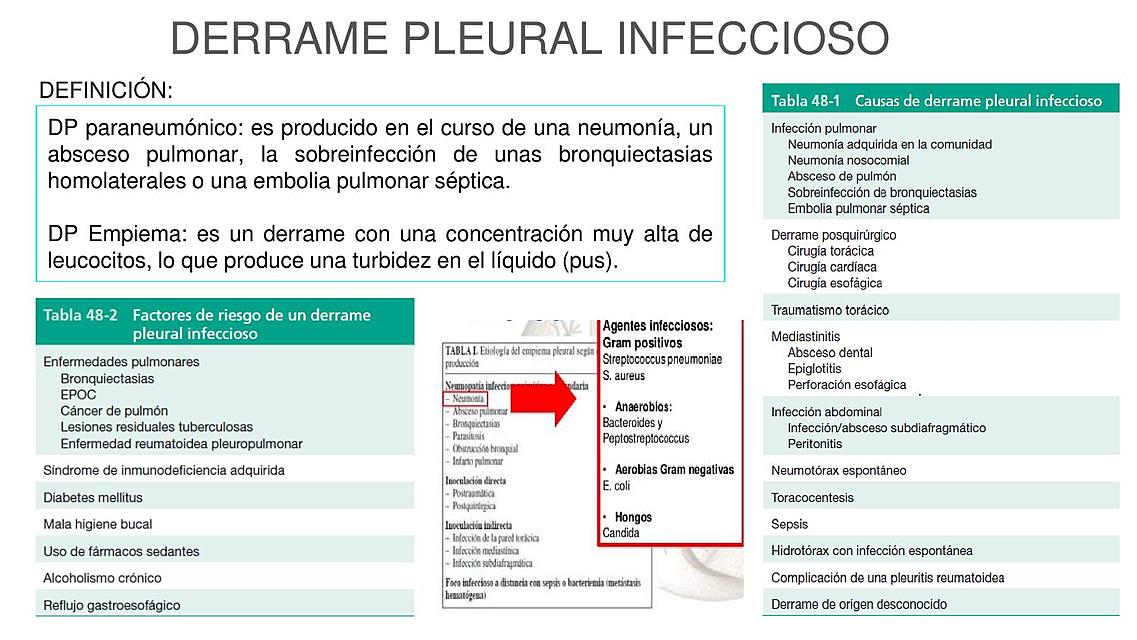 DP EMPIEMA | Viviana Tiravantty Becerra | uDocz