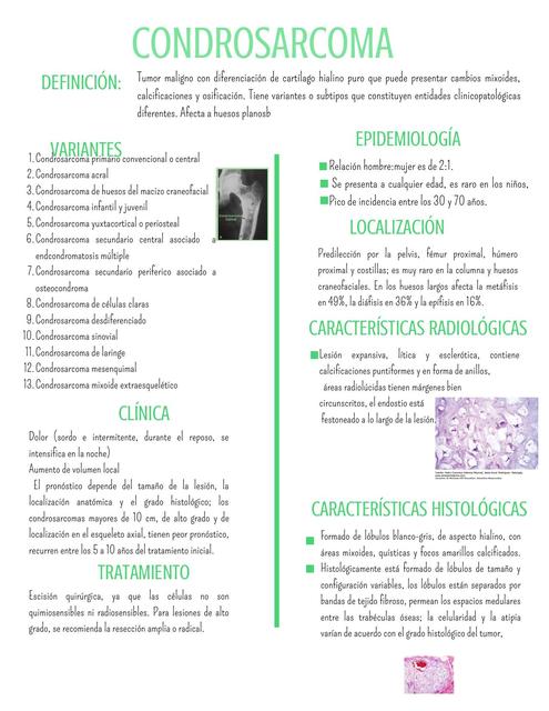 Condrosarcoma | Mar.Med | uDocz