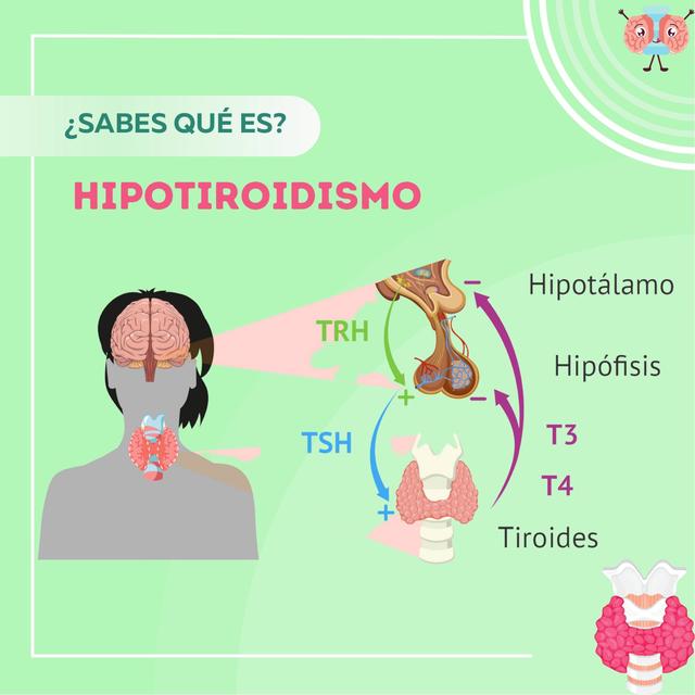 Hipotiroidismo | RoseMedScience ( Rose Mary Favier ) | uDocz