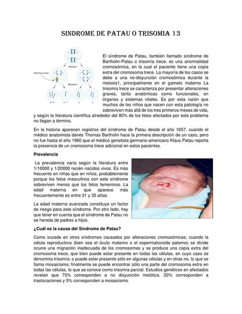Síndrome de Patau o Trisomía 13 | Yakeline Zambrana | uDocz