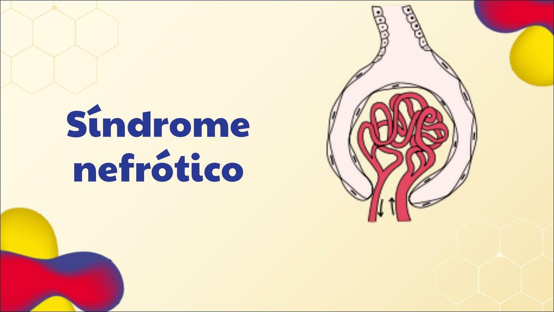 Síndrome Nefrótico | Dra Sayuri 👩‍⚕️🩺 | uDocz