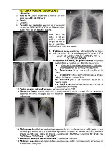 Radiografia De Torax Normal Rotulada Radiografía: Prueba Por