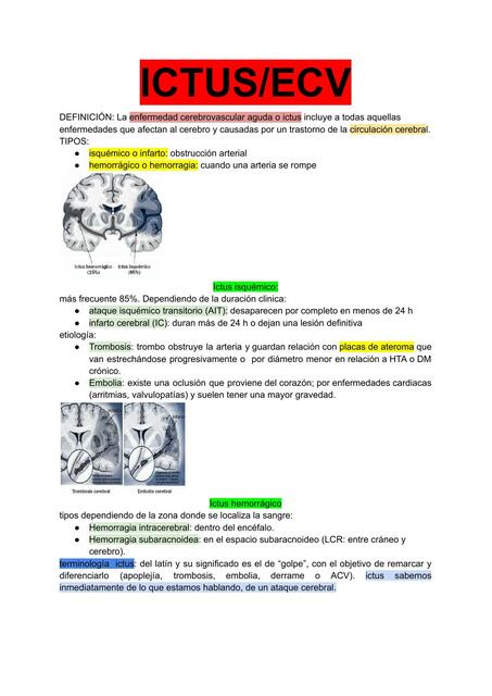 ICTUS/ECV | Moisés Francisco Alvarado García | uDocz