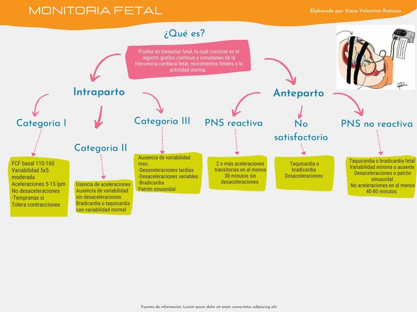 Monitoria Fetal | KIARA VALENTINA RAMIREZ ZAMBRANO | uDocz