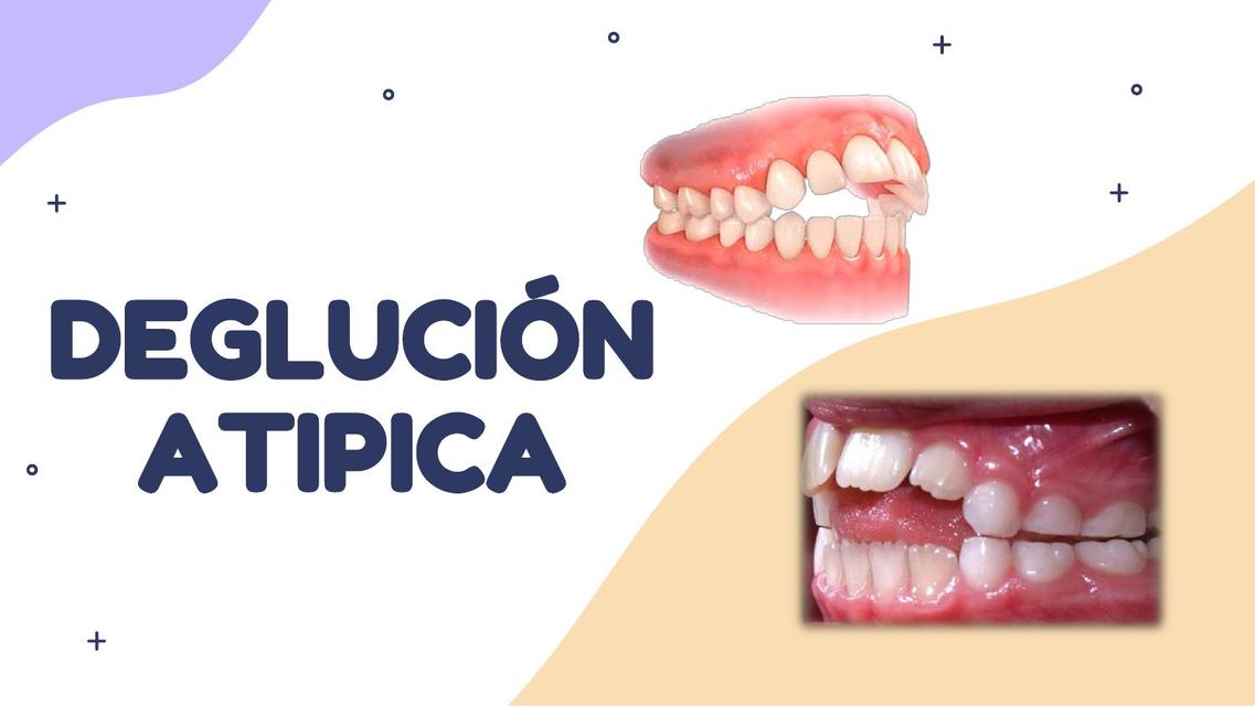 Deglución atípica | Michelle Pedroza | uDocz