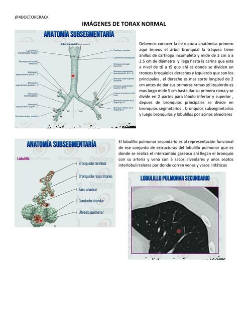 Imagenes de Tórax Normal | Enfermería | uDocz