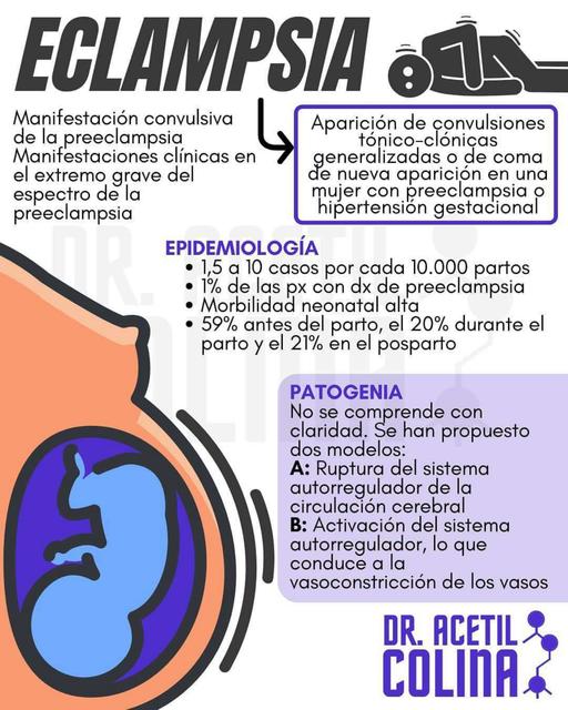 Eclampsia | YUDOC.ORG | uDocz