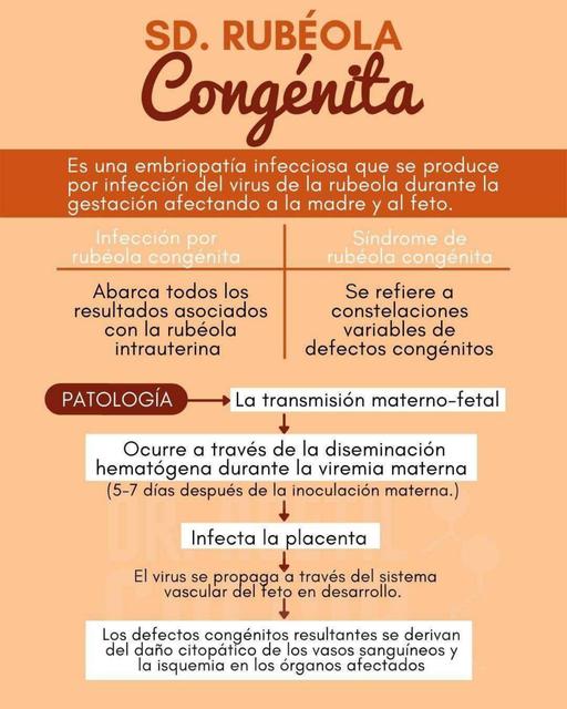 Síndrome de Rubéola Congénito | YUDOC.ORG | uDocz