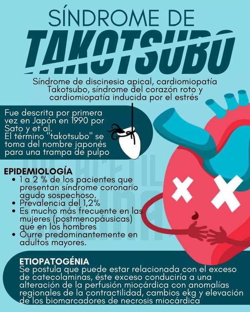 Síndrome de Takotsubo | YUDOC.ORG | uDocz