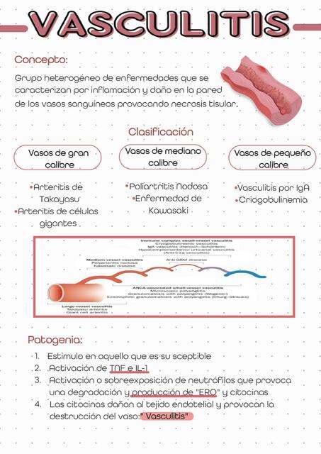 Vasculitis | Sandra Herrera Esparza | uDocz