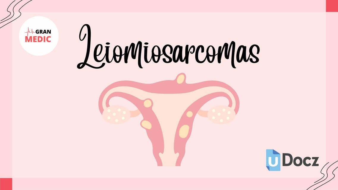 Leiomiosarcomas | Gran Medic | uDocz