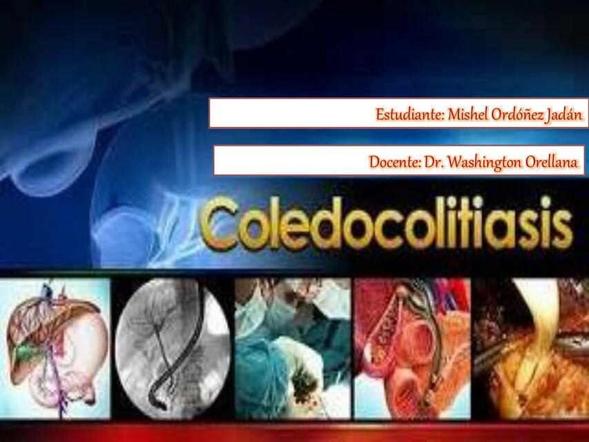 Coledocolitiasis | Mary Sanchez | uDocz