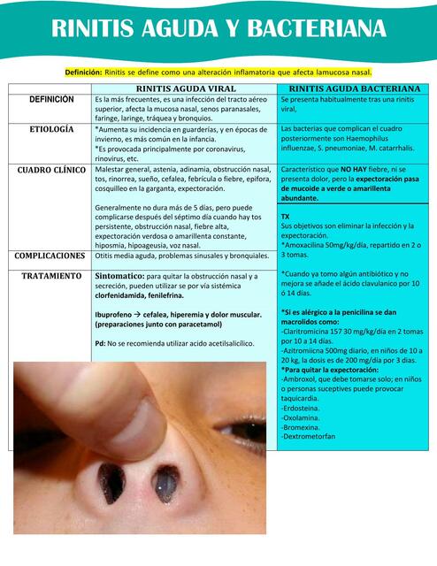 Rinitis Aguda y Bacteriana | PAOLA GUADALUPE MARTINEZ CARRANZA | uDocz