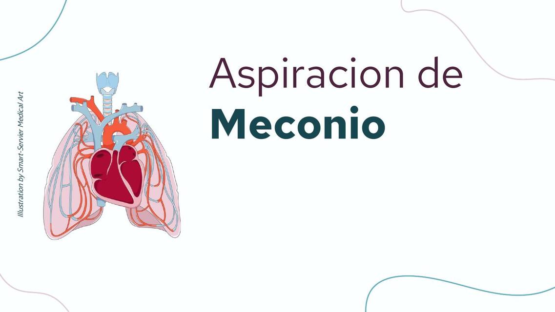 Aspiración de Meconio | META | uDocz