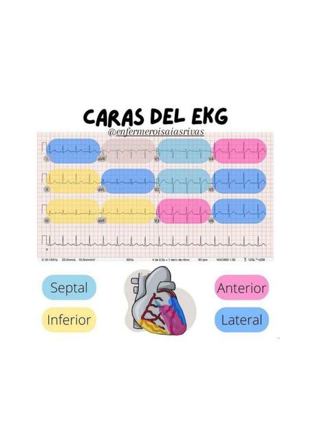 Caras del EKG | Enfermero Isaias Rivas | uDocz
