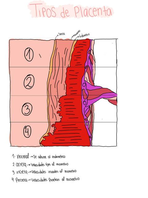 Tipos de Placenta | Chiqui Rojita | uDocz