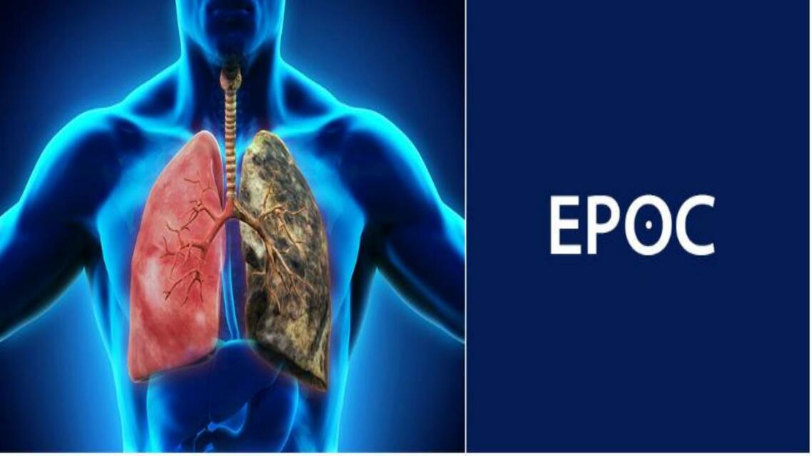 EPOC | Marivel Jaime | uDocz