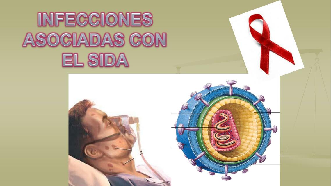 Infecciones Asociadas Con El Sida | CIENCIAS DE LA SALUD | uDocz