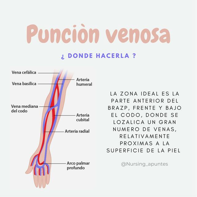 Punción Venosa | nursing apuntes | uDocz