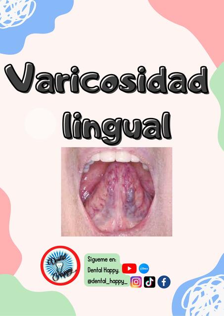 Varicosidad Lingual | Alan Díaz | uDocz