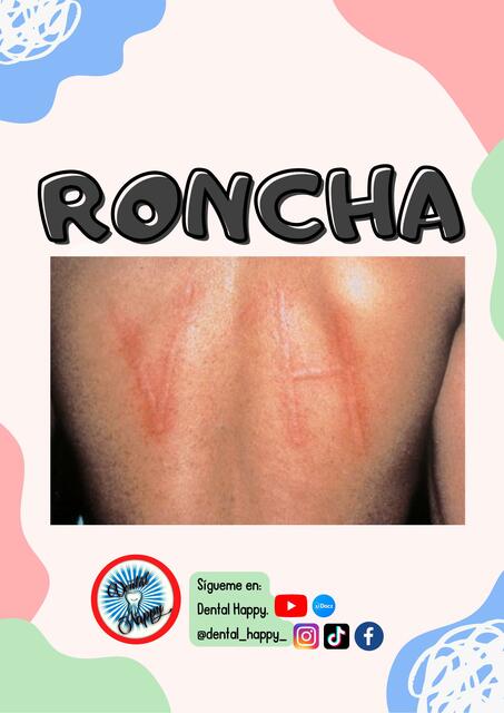 Roncha | Alan Díaz | uDocz