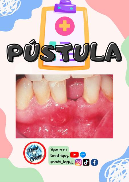 Pústula | Alan Díaz | uDocz