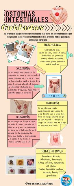 Ostomías intestinales | Enfermera.apuntesw | uDocz