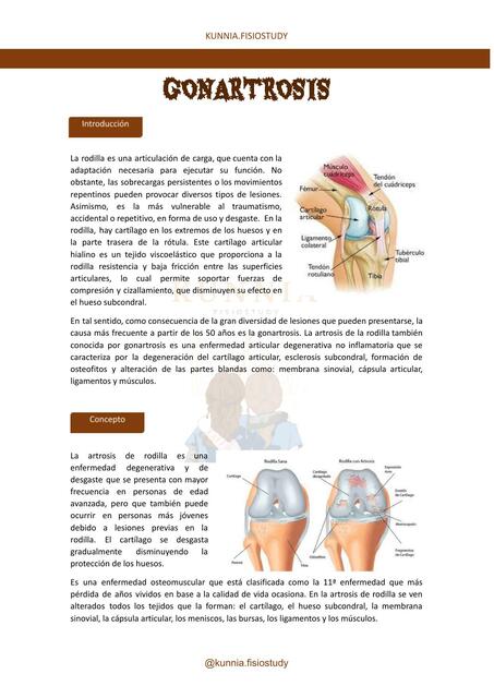 Gonartrosis | KUNNIAFISIOSTUDY | uDocz