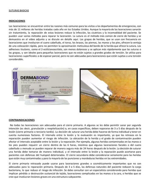 Suturas básicas | Lisette ResuMedIqObste | uDocz