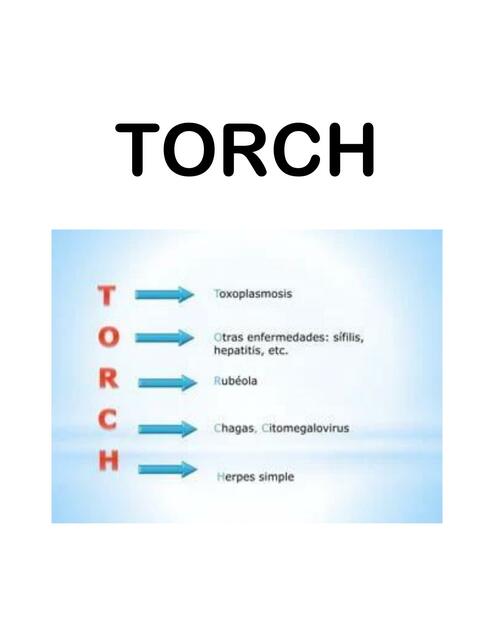 Torch | JENNIFER AVALOS TORRES | uDocz