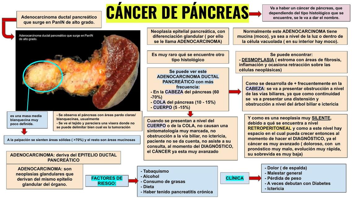 Cáncer De Páncreas | Gabriela Cuellar Corilla | uDocz