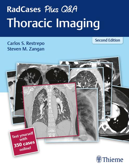 Thoracic Imaging | Enfermería | uDocz