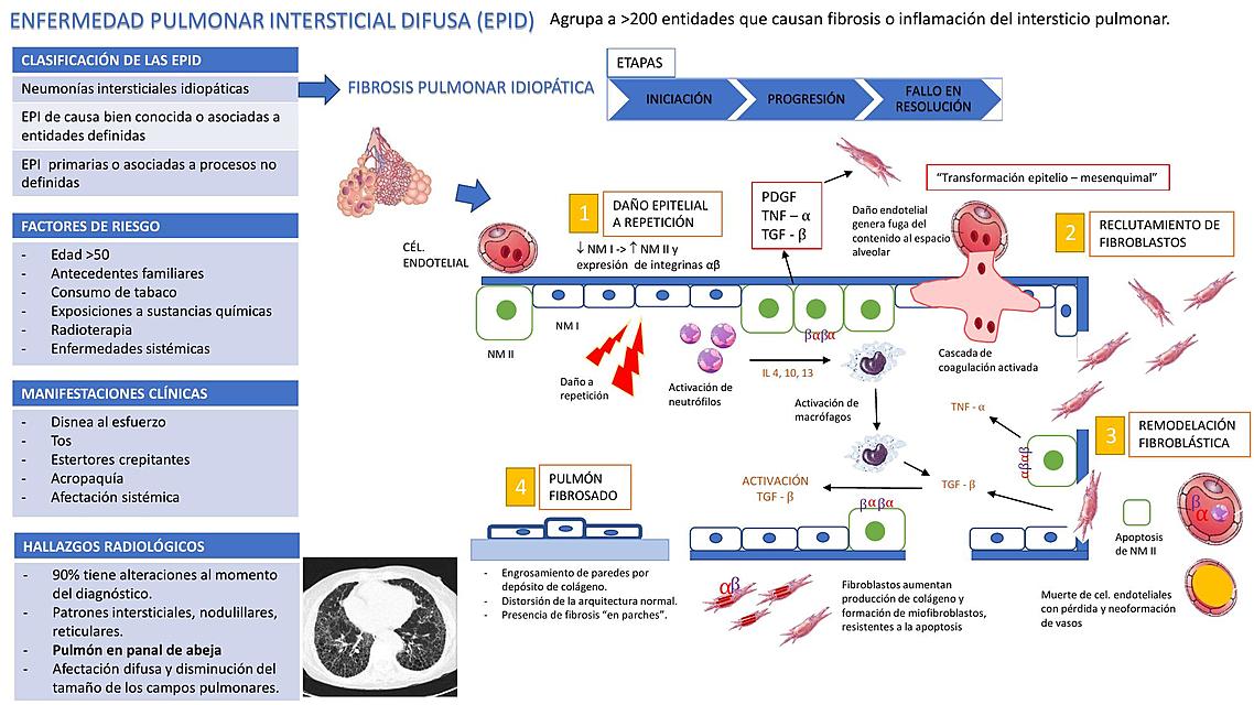 EPID | Jean Pierre Zamora | uDocz