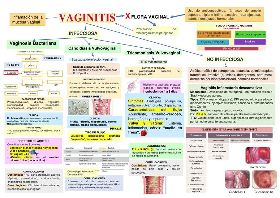 Vaginitis | Yubely Gálvez | uDocz
