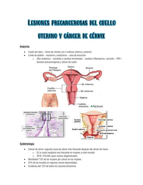 Lesiones precancerosas del cuello uterino y cáncer | Aleja Huertas | uDocz