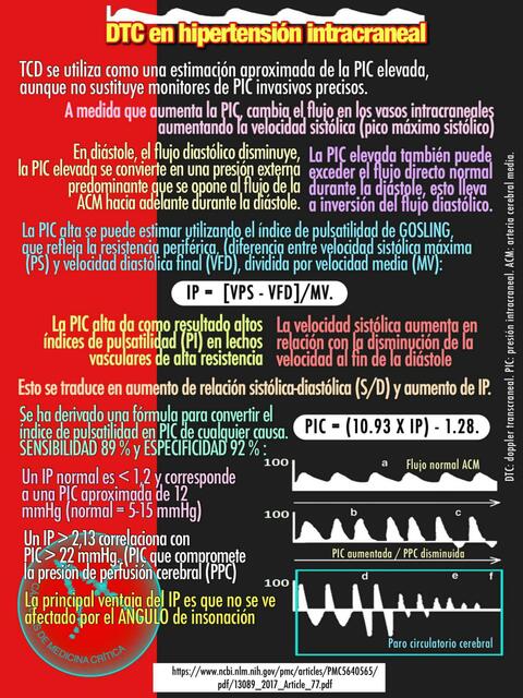 Doppler Transcraneal Hipertensión Intracraneal | YUDOC.ORG | uDocz