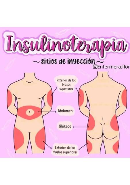 Insulinoterapia | Enfermería | uDocz