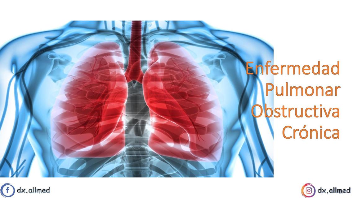 ENFERMEDAD PULMONAR OBSTRUCTIVA CRÓNICA | dx.allmed | uDocz