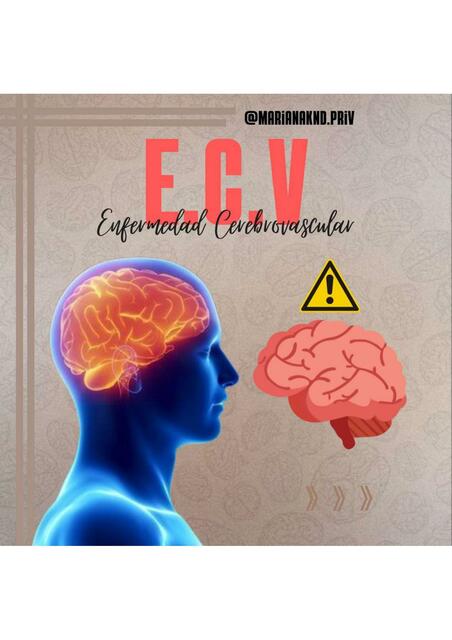 ECV (Enfermedad Cerebrovascular) | KARINA DÍAZ | uDocz