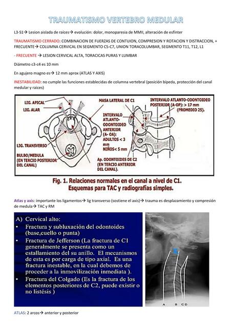 Traumatismo vertebro medular | Mishelle Chavez | uDocz