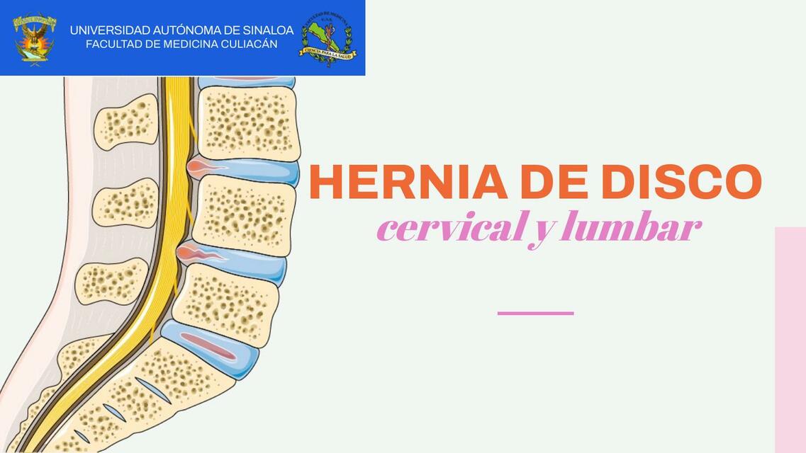 Hernias Discales | MSR | uDocz