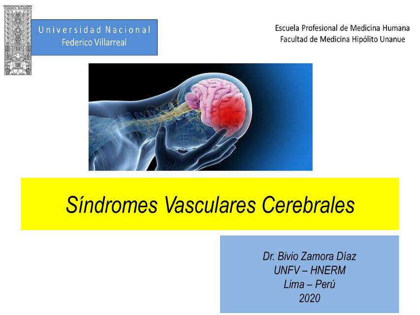 Síndromes Vasculares Cerebrales | shadow | uDocz