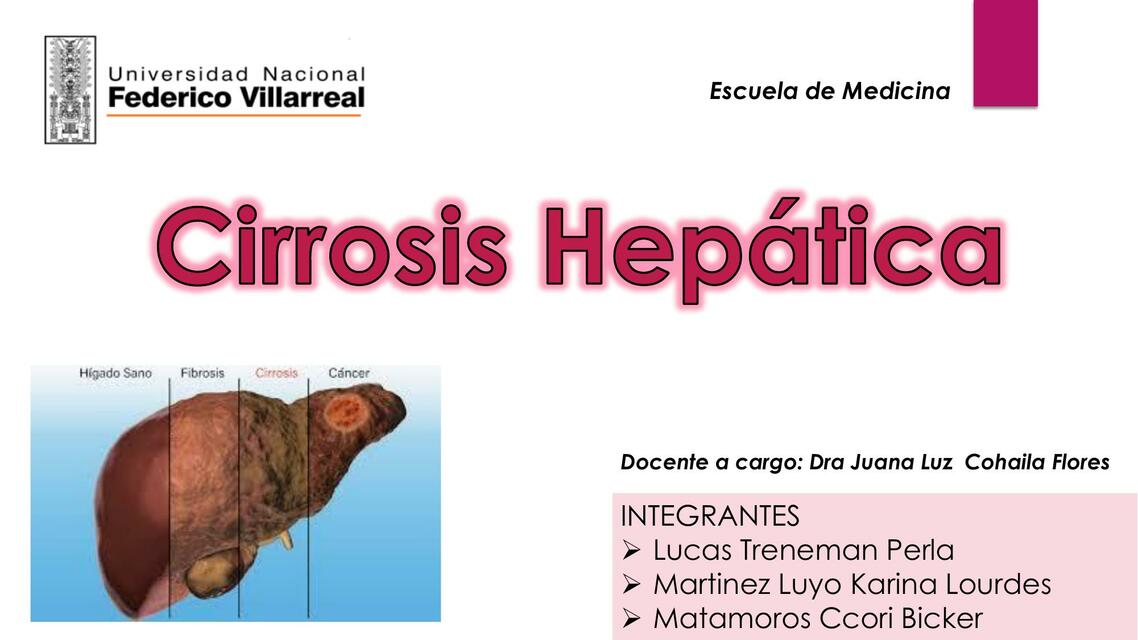 Cirrosis Hepática | shadow | uDocz