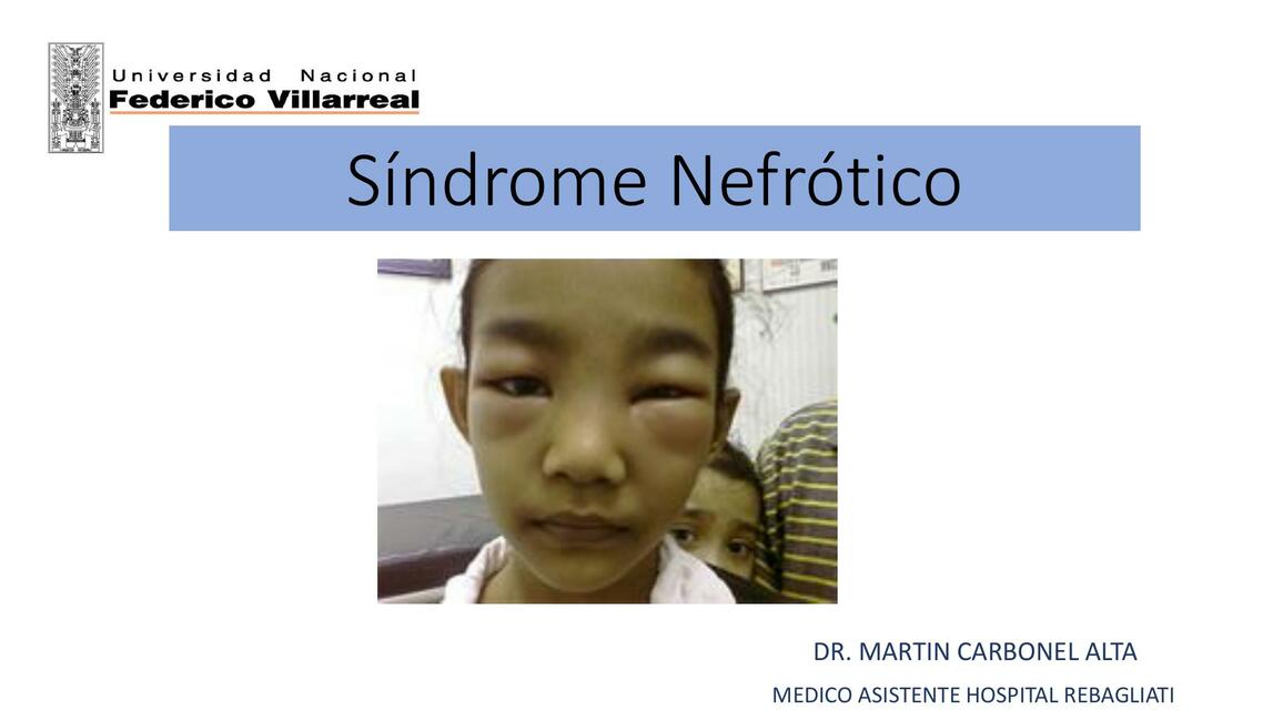 Síndrome Nefrótico y Nefritico | shadow | uDocz